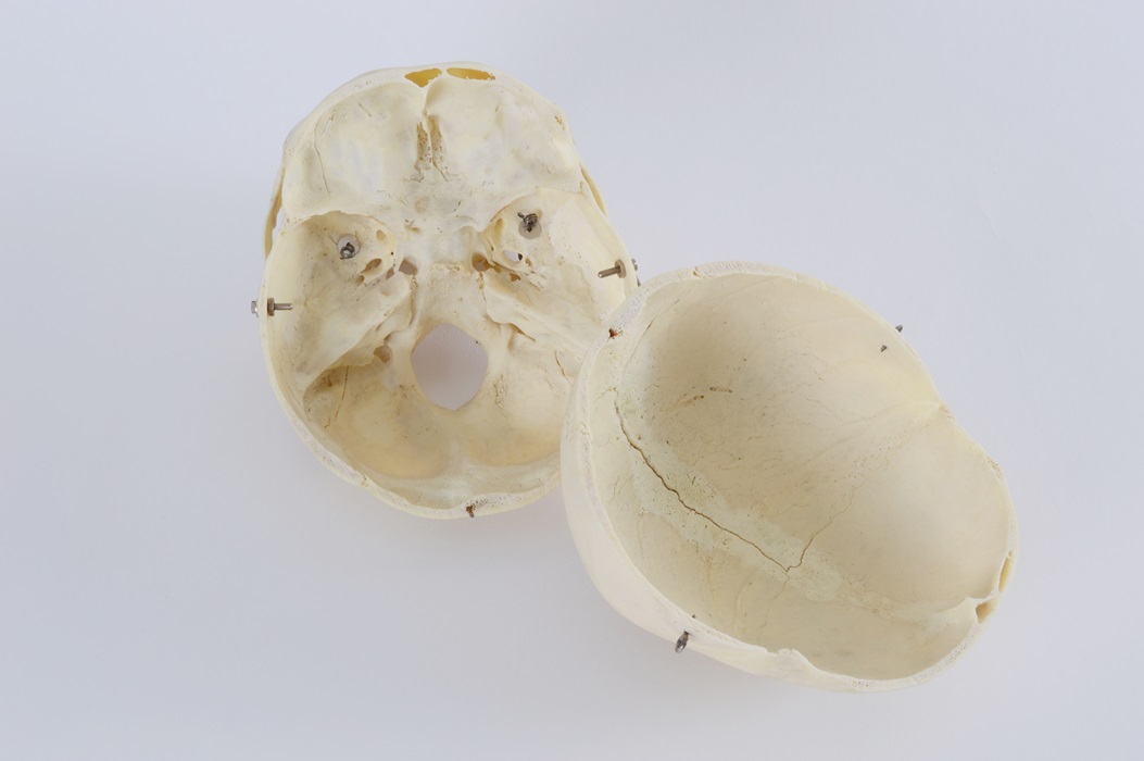 Authentic Human Skull | EBTH